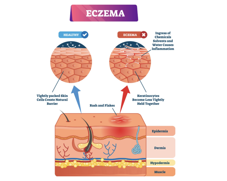 7 Causes of Itchy Skin [Pruritus]: Treatments for Rashes, Bumps & More ...